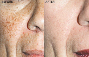 Skinnovate | Clinical Skin Studio